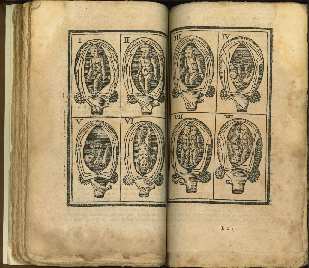 Midwifery: A Historical Review of Shifting Approaches to Women’s Health ...